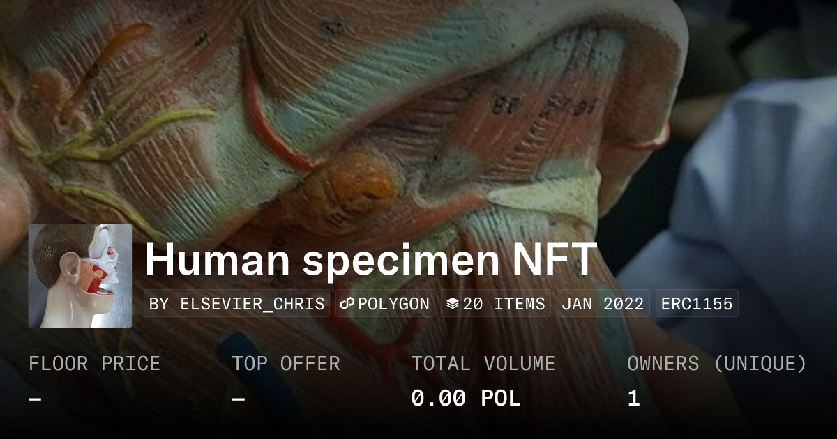 Human specimen NFT - Collection | OpenSea