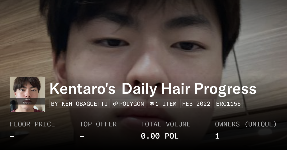 Kentaro's Daily Hair Progress - Collection | OpenSea