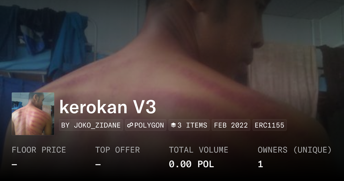 opengraph-image?ts=29209398