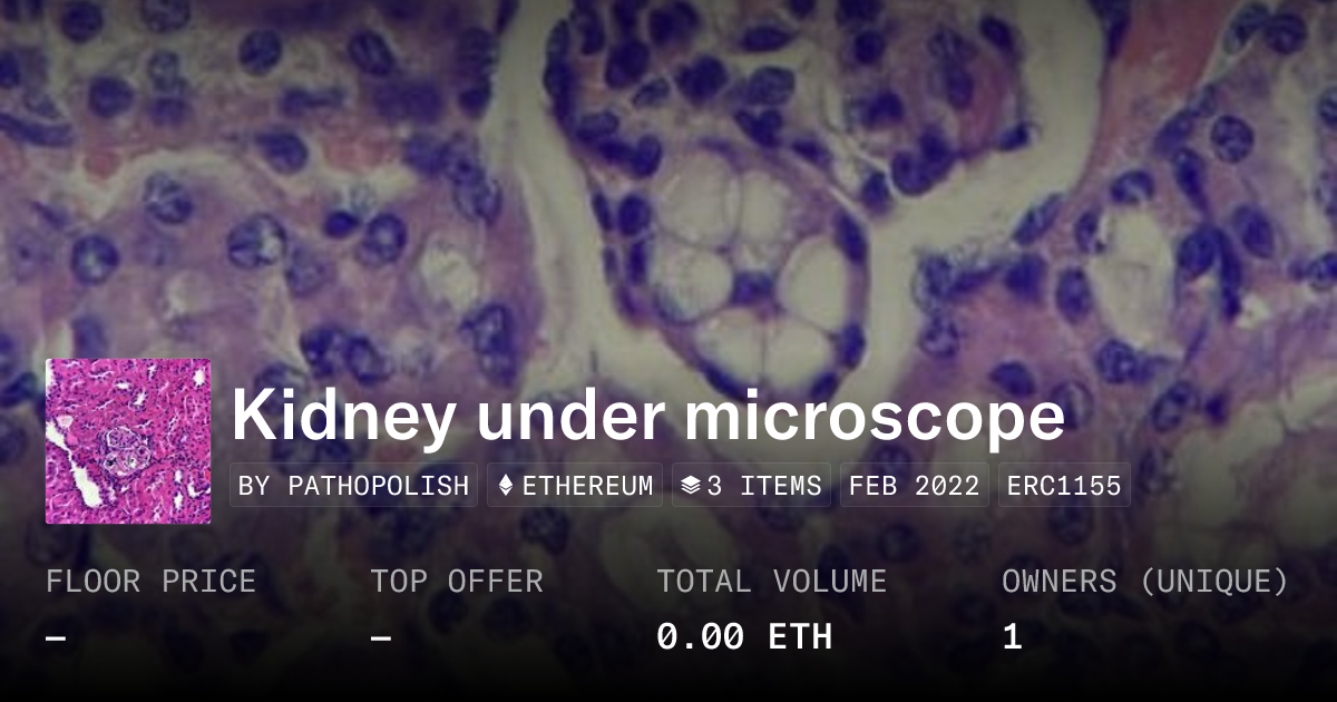Kidney under microscope - Collection | OpenSea