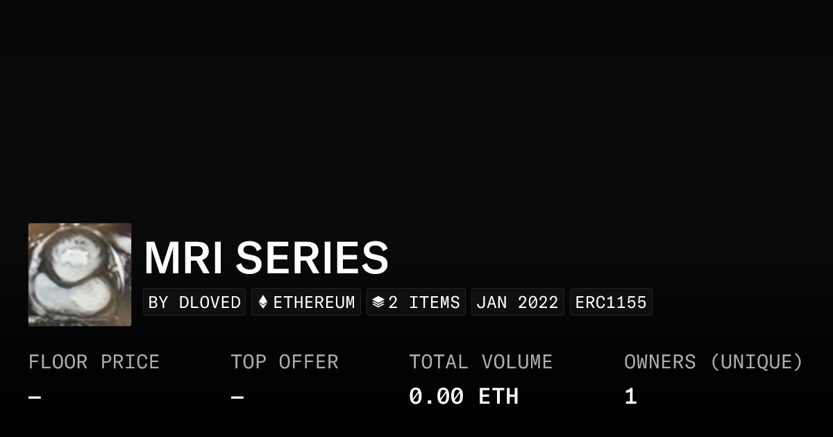 opengraph-image?ts=29172322