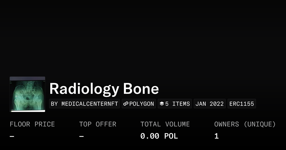 Radiology Bone - Collection | OpenSea
