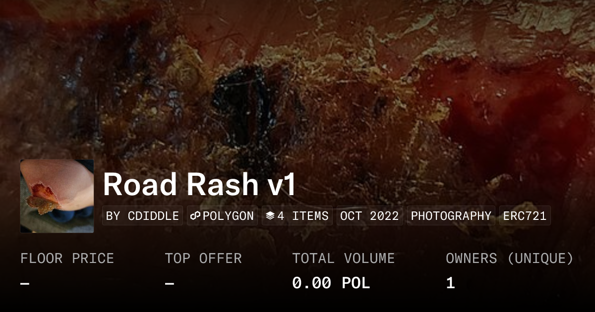 Road Rash v1 - Collection | OpenSea