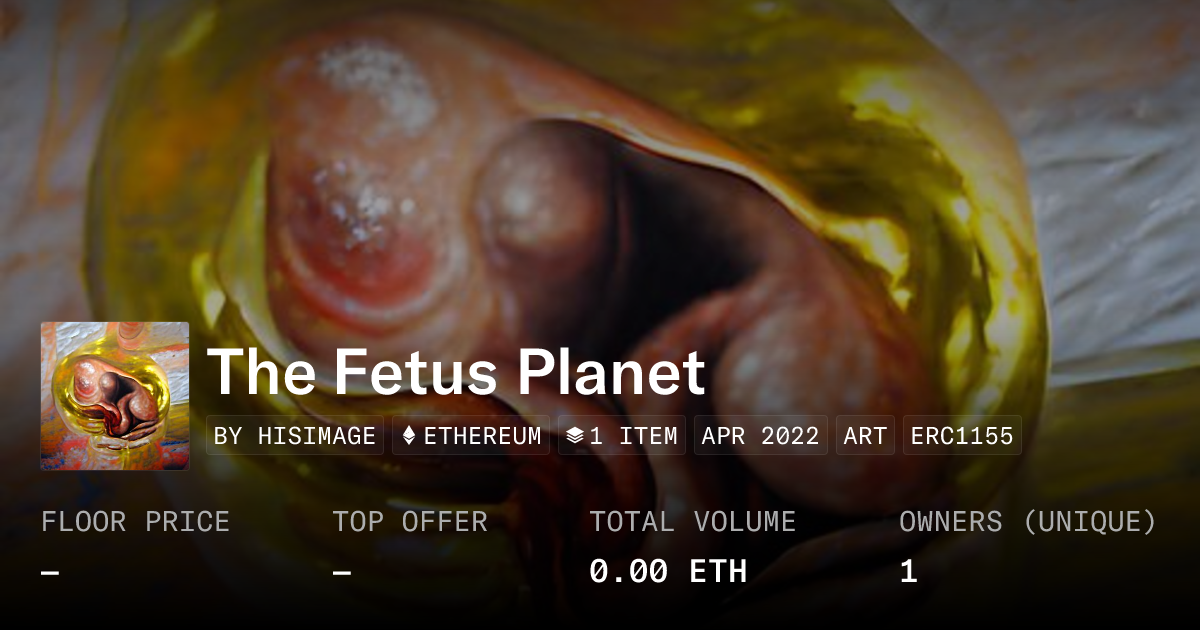 opengraph-image?ts=29201498